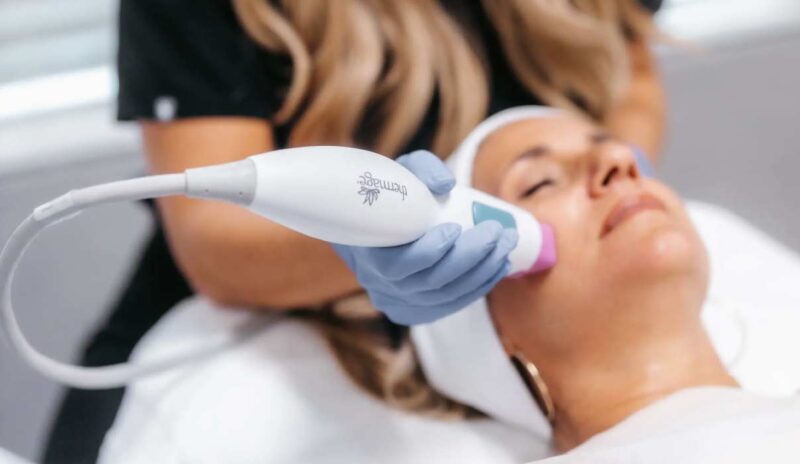 Thermage FLX | Quartz Surgical Hospital